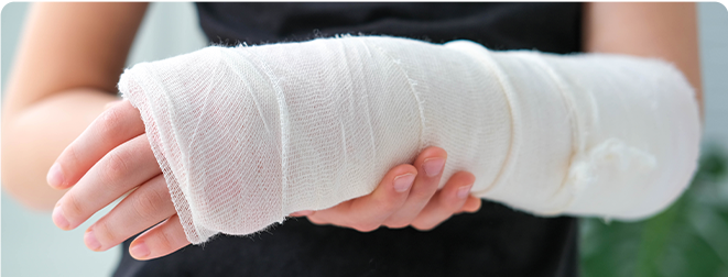 Taking Care of Casts and Splints - Campbell Clinic Orthopaedics
